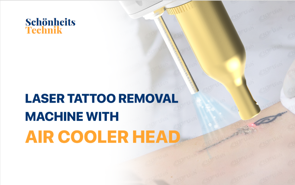 LASER TATTOO REMOVAL - schonheitstechnik